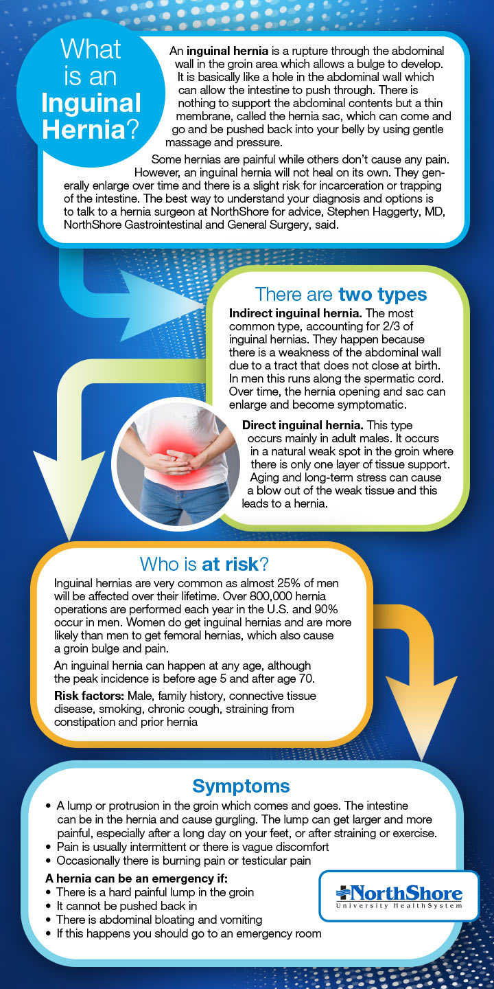 Inguinal Hernia Warning Signs Symptoms NorthShore Inguinal Hernia Warning Signs Symptoms NorthShore
